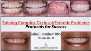 Thank You Solving Complex Occlusal/Esthetic Problems